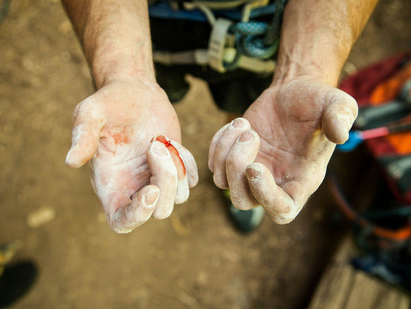 How to Know If Bleeding is Serious - Medical Gear Outfitters Blog ...